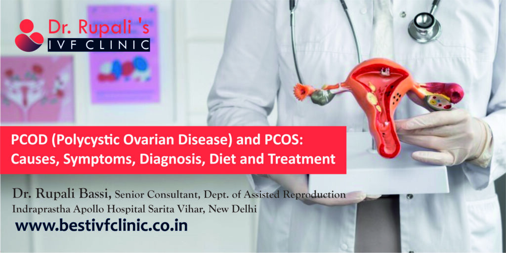 PCOD (Polycystic Ovarian Disease) and PCOS: Causes, Symptoms, Diagnosis ...