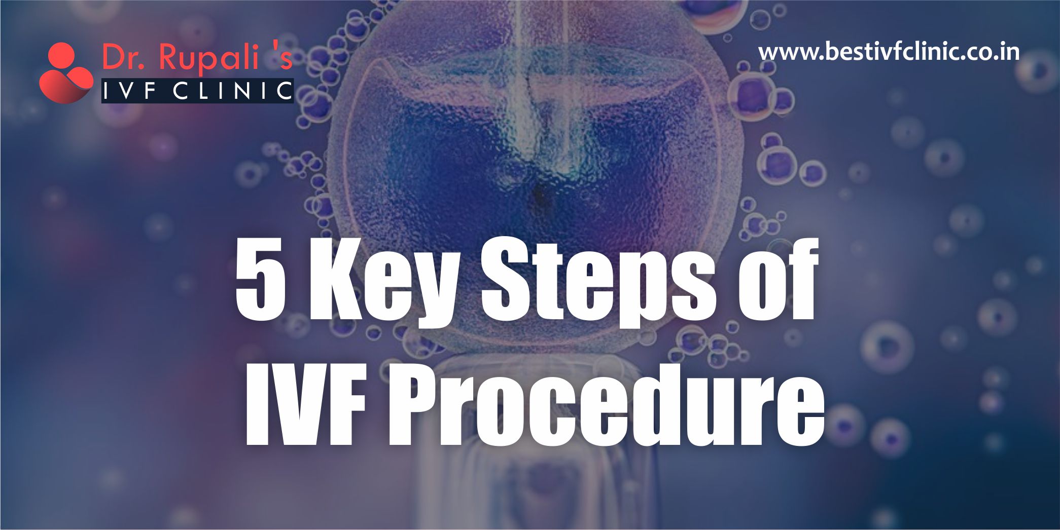 5 Key Steps of IVF Procedure